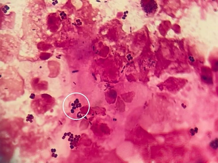 Lapin qui éternue quand s'inquiéter ? - Le meilleur pour mon Lapin